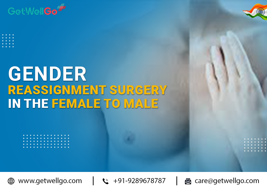 Gender Reassignment Surgery: Female to Male Procedure Gender Reassignment Surgery: Female to Male Procedure